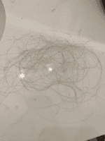 How To Stop Telogen Effluvium Hair Loss - Mornings on Macedonia